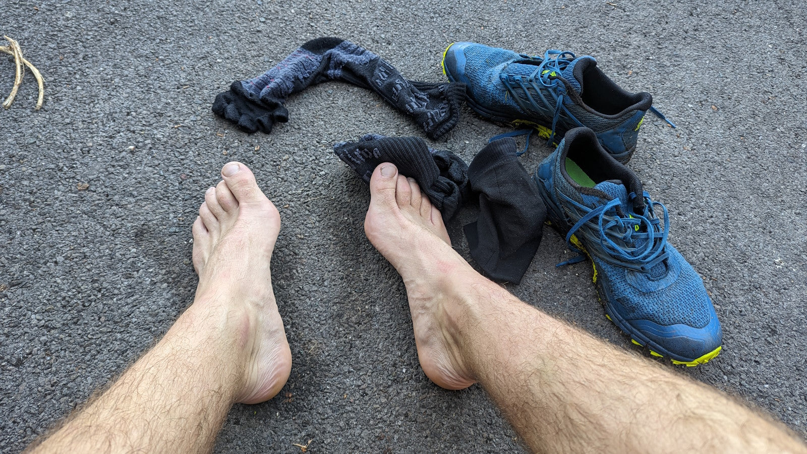 Athlete's Foot vs Dry Skin: How to Spot the Difference | The Feats